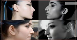 Celebrating Diversity: Exploring the Fascinating World of Nose Shapes ...